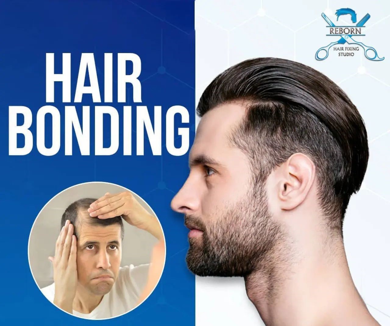 hair bonding Hyderabad - Reborn Hair Fixing Studio